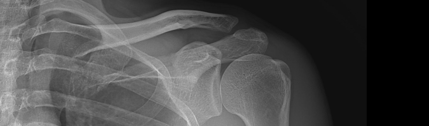 Shoulder Surgeon Detroit - Ben Mayo, MD